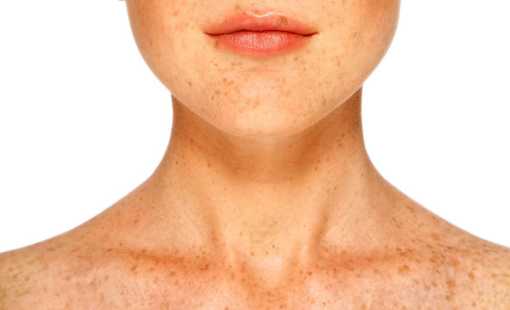 Why We Love Hydroquinone for Hyperpigmentation – Dr. Sylvia Skincare